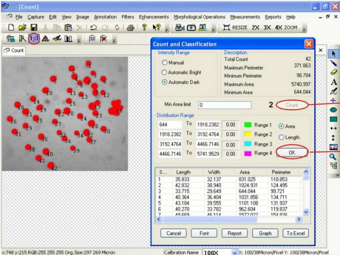 Metallographic Image Analysis Software MetaVision For Metallurgical ...